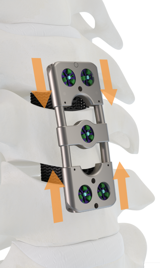 Active - Nexus Spine