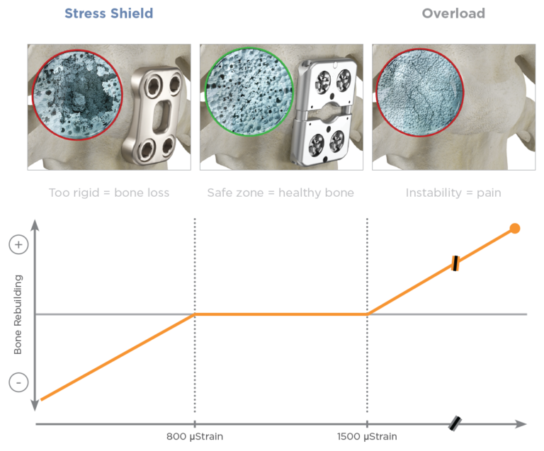 Active - Nexus Spine