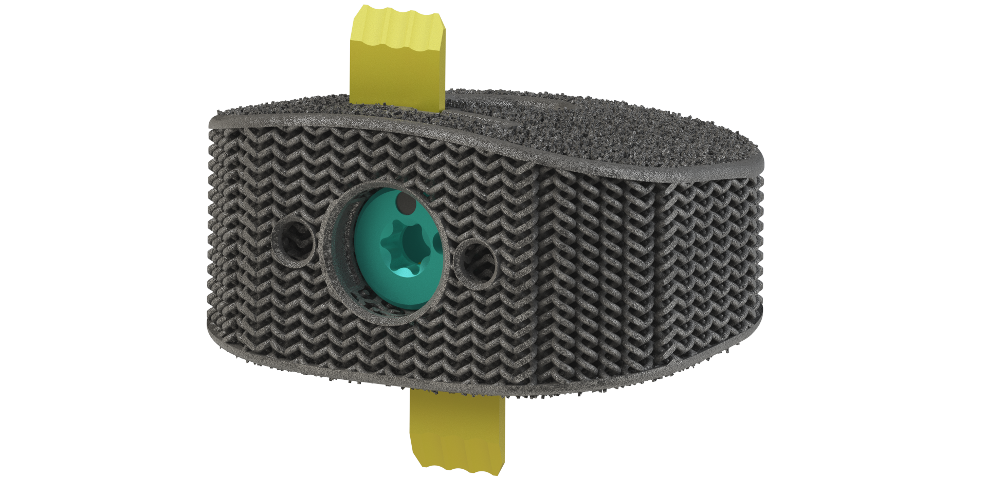 Nexus Spine Obtains a U. S. Patent that Addresses Flexible, Porous ...